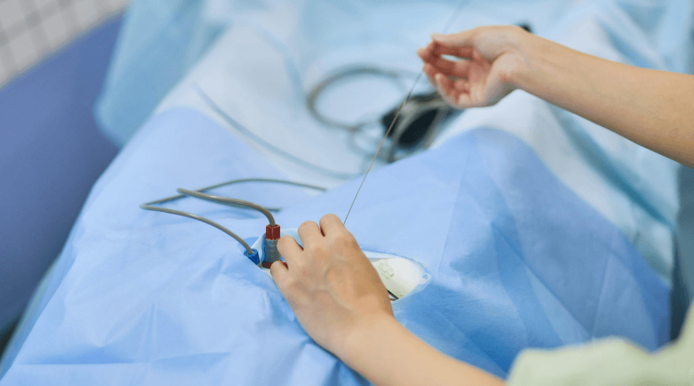 FDA Early Alert on Cook Medical Sizing C... | STAT Surgical Supply